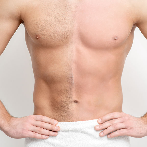 Haarentfernung in Pasching in Linz-Land - Studio Haarlos in Pasching